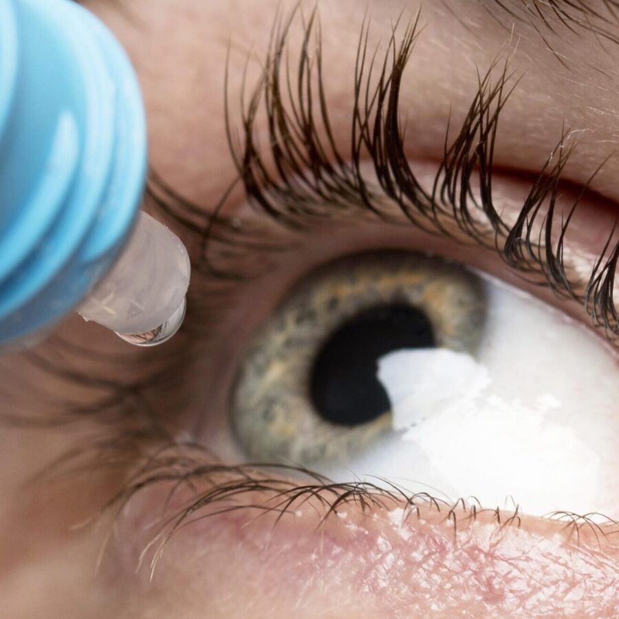 ¿Qué es la fotofobia y cómo se puede tratar?